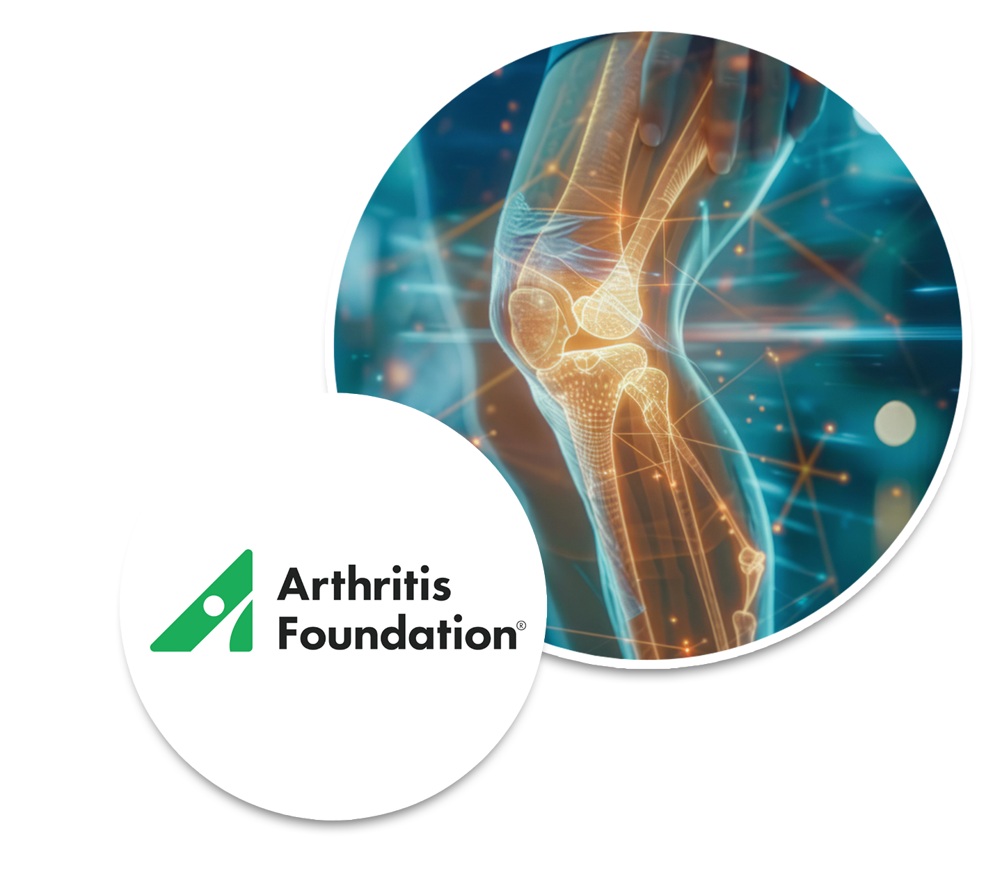 Knee pain coaching program